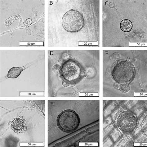 Phylogenetic Relationships Between Pythium And Phytophthora Spp Download Scientific Diagram