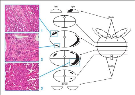 Topographical Map Of The Prostate Of Patient No 10 Including The Download Scientific Diagram