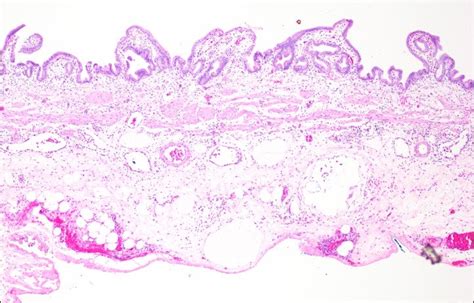 Gallbladder Normal Histology Nus Pathweb Nus Pathweb