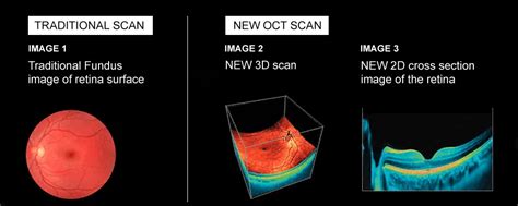 Oct Scan Eyeworks Opticians Redhill Surrey 01737 778877