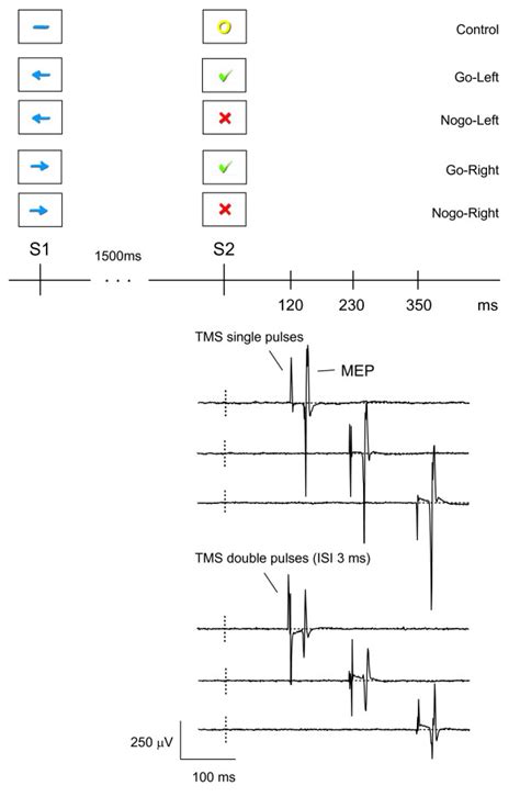 Illustration Of The Go Nogo Task S1 S2 Paradigm The Go Nogo Task Download Scientific Diagram
