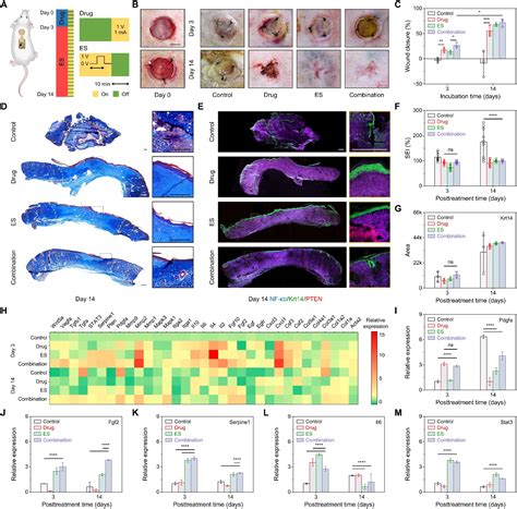 加州理工学院高伟教授团队《sci Adv 》 慢性伤口感染检测和治疗的可穿戴生物电子系统 中国聚合物网科教新闻