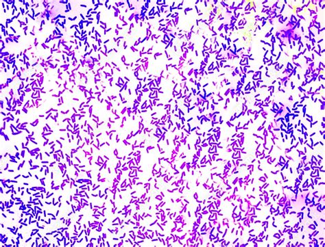 Lactobacillus Spp Bacteria Micrograph 이미지 2181877606 일러스트 무료 일러스트 게티이미지뱅크