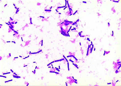 Gram Stain Of The Positive Anaerobic Blood Culture Bottle Showing