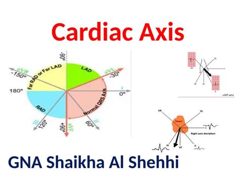 Lecture On Cardiac Axis On Ecg For Nurses Pptx