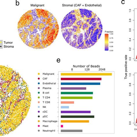 Application Of Spacet To A Colon Cancer Slide Seq Dataset A The