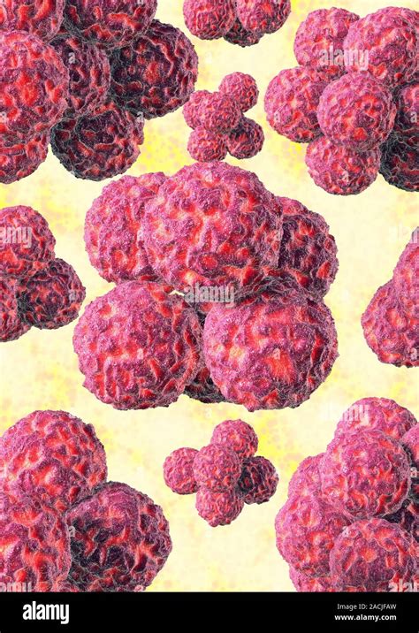 Mrsa Bacteria Computer Artwork Of Clusters Of Methicillin Resistant Staphylococcus Aureus Mrsa