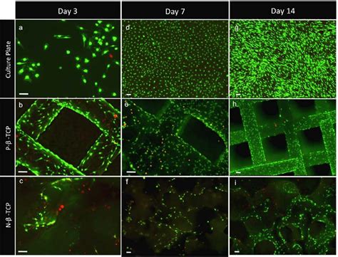 Bone Regeneration Is An Advancing Field Of Research Ossiform W E