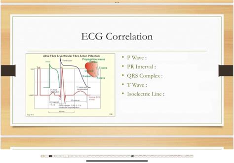 Ekg Pqrst 심방세동 심방조동 심실세동 심실빈맥 조기심실수축 차이 공부하기 네이버 블로그