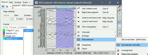 Tutorialsepileptogenicity Brainstorm