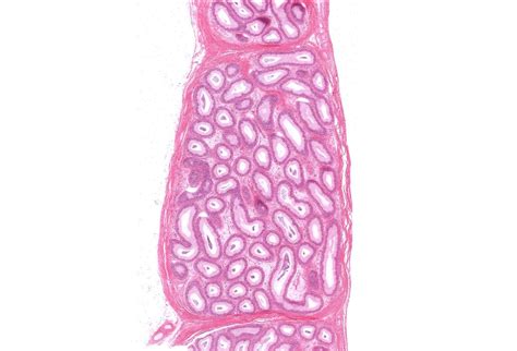 μicroscopia Epididimo