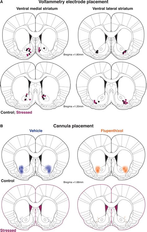 Nucleus Accumbens Infralimbic Cortex Reward Prefrontal Extinction Contributions Differential