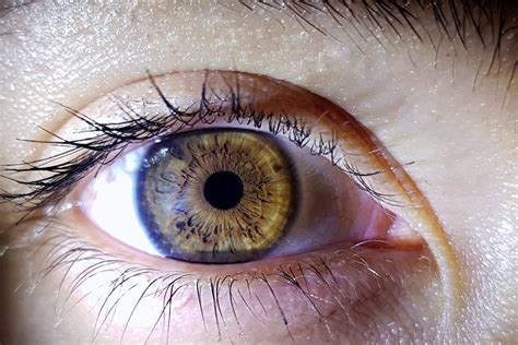 Colour Vision Report Gildeas Opticians