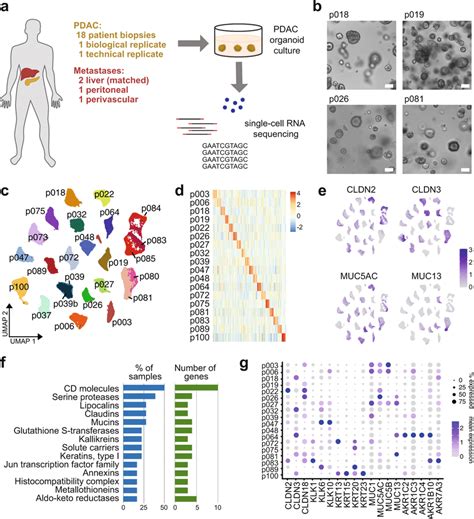 Intertumor Heterogeneity In Patient Derived Pdac Organoids A Schematic