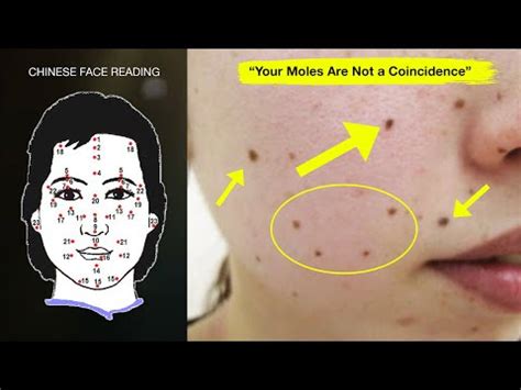 Your Moles Are Clues For Personal Development Unlimited