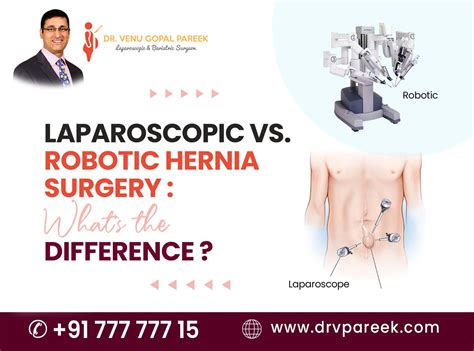 Laparoscopic Vs Robotic Hernia Surgery Whats The Difference