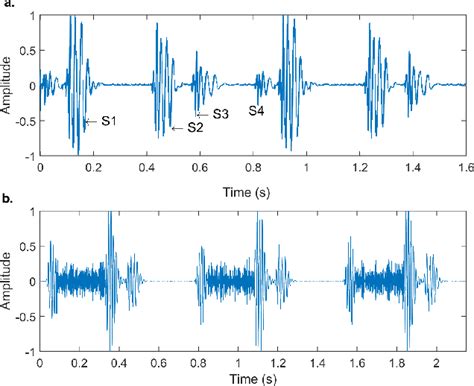 Figure 1 From Heart Valve Defect Detection From Pcg Signals Using
