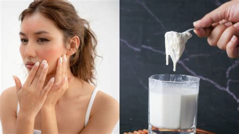 Malai For Skin Rashes চুলকানি থেকে জ্বালাভাব—দুধের সর মাখলেই পাবেন নরম ত্বক Bengali News
