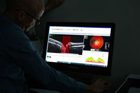 What Is A Oct Scan Conor Fleming Opticians