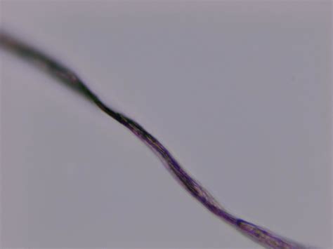 This Is Only A Few Of The Photos From 2500x And 1000x Of The Lyme