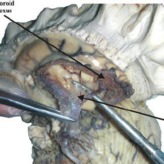 PDF The Choroid Plexus A Comprehensive Review Of Its History Anatomy Function Histology