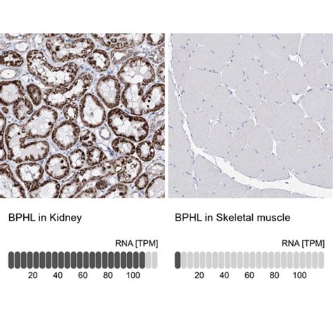 Rabbit Polyclonal Anti Bphl Antibody Buy For Research Highly Specific Rigorously Validated