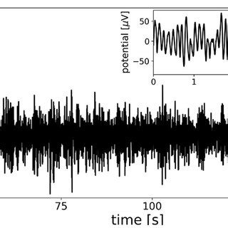 The Overall Structure Of The EEG Time Series Is Visualized By The First Download Scientific