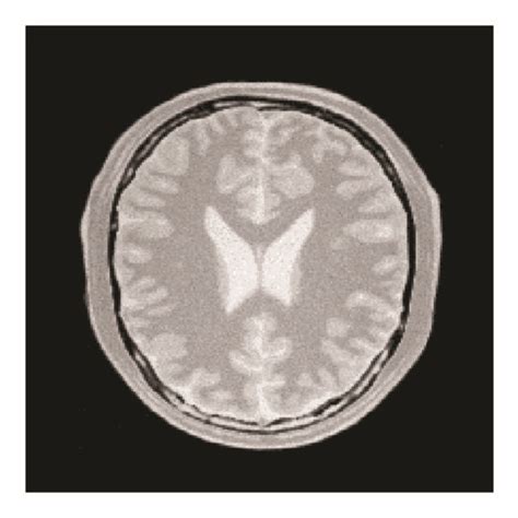 Segmentation Results Obtained By Otsu Download Scientific Diagram