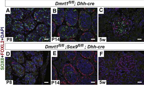 Dmrt1 Protects Male Gonadal Cells From Retinoid Dependent Sexual Transdifferentiation