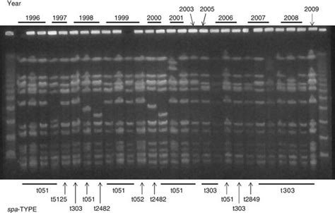 Clonality Of The Isolates And Spa Type Evolution Pfge Smai Of 28 Mrsa