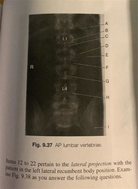 solved 11 identify each lettered structure of the lumbar