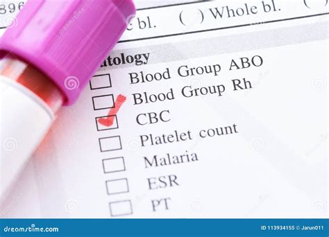 Blood For CBC Test Stock Image Image Of Research Health 113934155