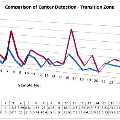 Flowchart Of Prostate Cancer Detection And Localization By Zones