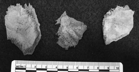 Skull Fragments 953 Showing Evidence Of Perimortem Fractures And