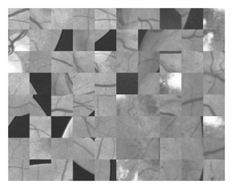 patches sampled for model training a the preprocessed patches b