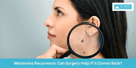 Melanoma Recurrence Surgery Can It Help You Far North Surgery