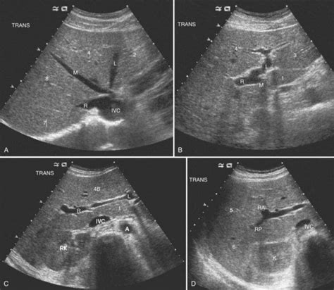 Best 25 Ultrasound Ideas On Pinterest Ultrasound School Sonography Course And Sonography