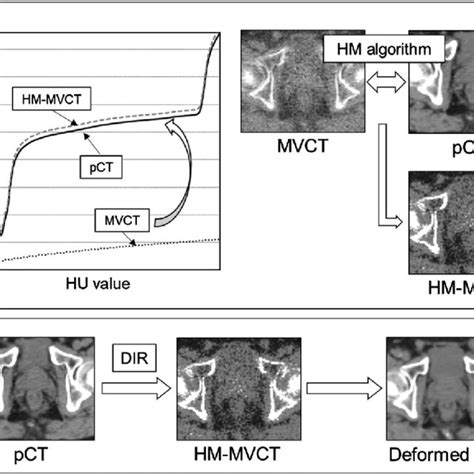 Demonstrates The Workflow Of The Deformable Dose Accumulation In Download Scientific Diagram