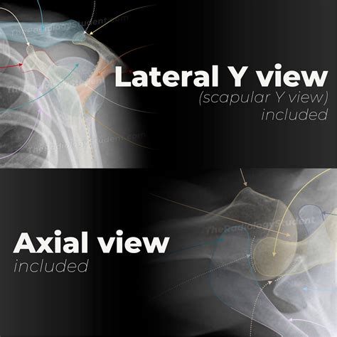Shoulder X Ray Anatomy Quiz