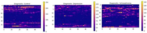 Convolutional Neural Network For Depression And Schizophrenia Detection