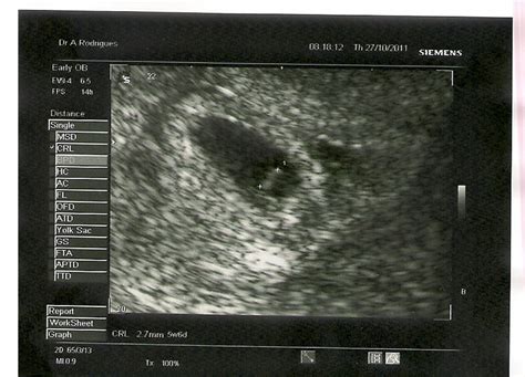 My First Scan W D