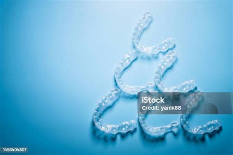 파란색 배경에 피라미드 모양의 치아를위한 투명한 교정기 치과 및 치열 교정 현대 의학의 3d 프린팅 0명에 대한 스톡 사진 및 기타 이미지 Istock