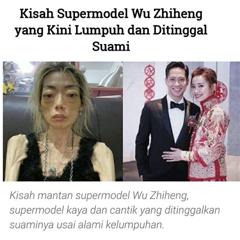 Cerita Super Model Cewek Cantik Wu Zhiheng Yang Kini Lumpuh