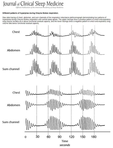 Two Distinct Patterns Of Hyperpnea During Cheyne Stokes Respiration
