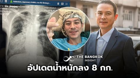จั๊ก ชวิน อัปเดตน้ำหนักลง 8 กก แต่อาการดีขึ้น หลังติดเชื้อวัณโรคจากเพื่อนที่เพิ่งเสีย
