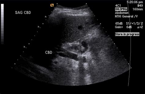 მედიცინა Medicine Dr გიორგი სამადაშვილი Q U E S T I O N N 5 45 წლის ჭარბი წონის ქალბატონი