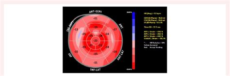 Strain Analysis Ruled Out Cardiac Amyloidosis Download Scientific