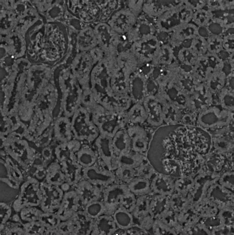 Segmenting Glomeruli And Other Structures From Synchrotron X Ray Microtomography Datasets Infravis