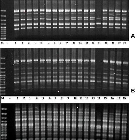 Representative Electrophoresis Gel Picture Showing Rapd Pcr Download Scientific Diagram