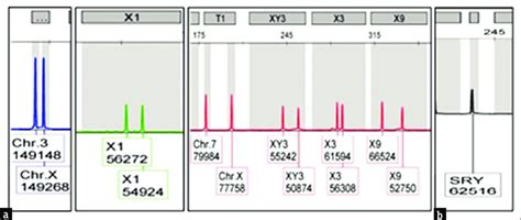 Qf Pcr A Confirmed The Presence Of 2 X Chromosomes And B Revealed Download Scientific